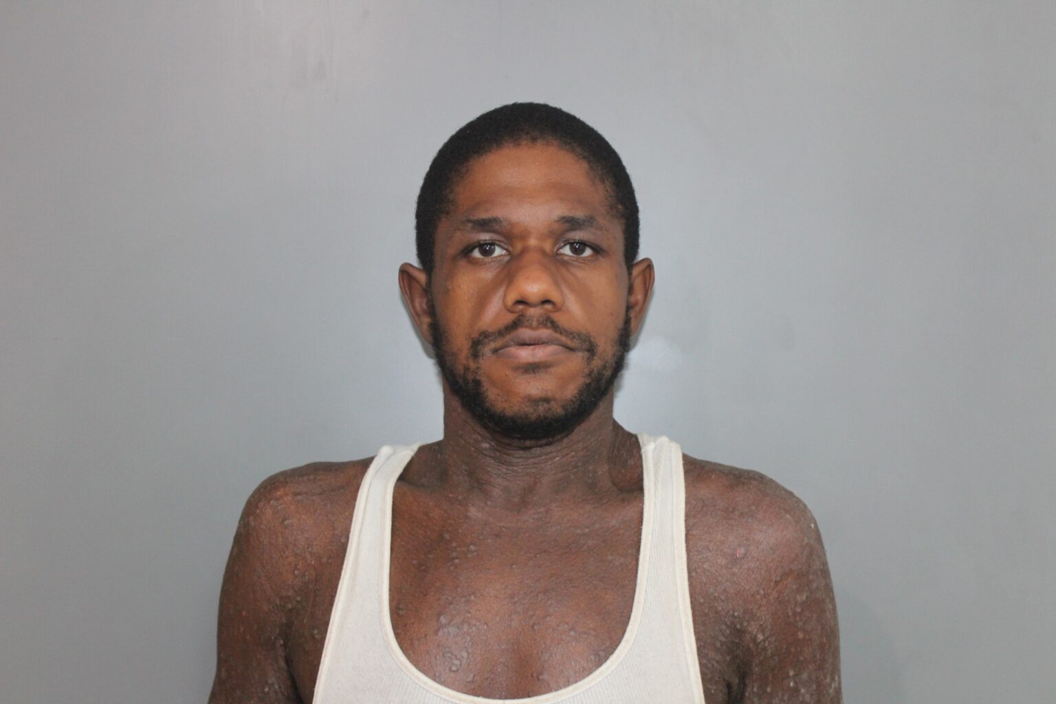 Patrol Officers Arrest Suspect in a Domestic Violence Assault Incident ...